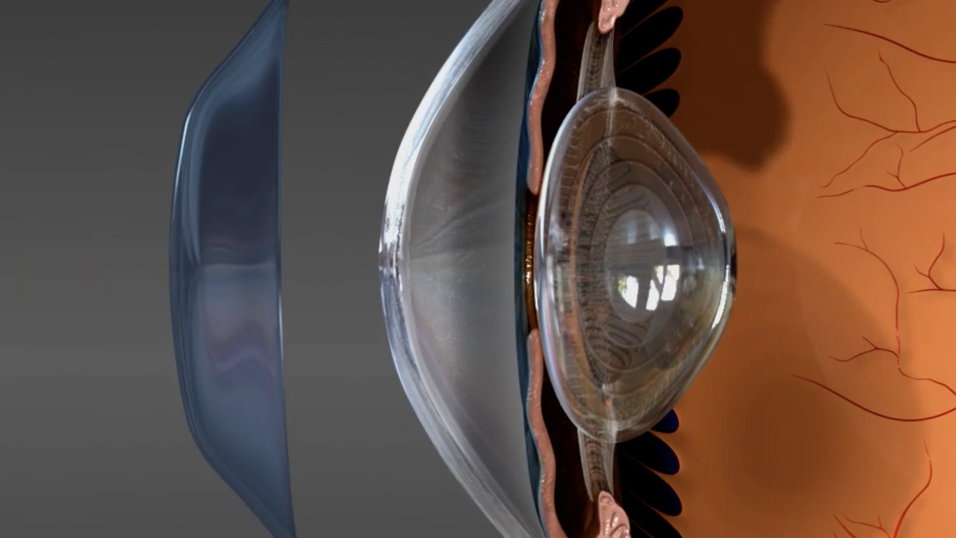 Myopia Control | EYETECH